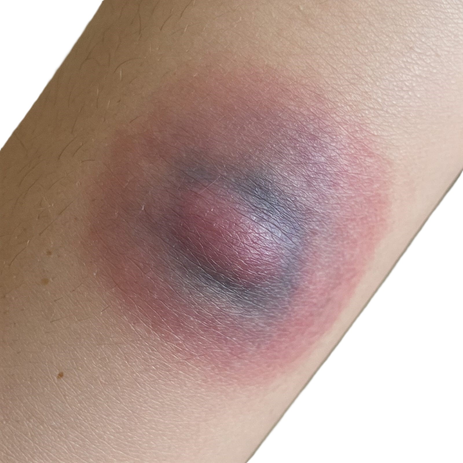 Dr. Rodrigo León García | Ortopedista y Traumatólogo en CDMX